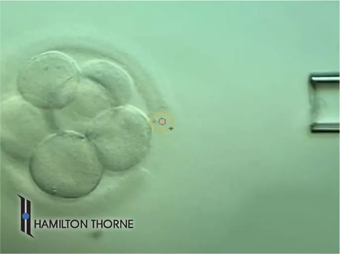 Hamilton Thorne ZILOS-tk® Clinical laser