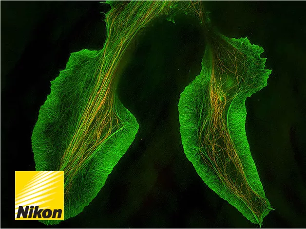 Nikon Super-Resolution Microscopes