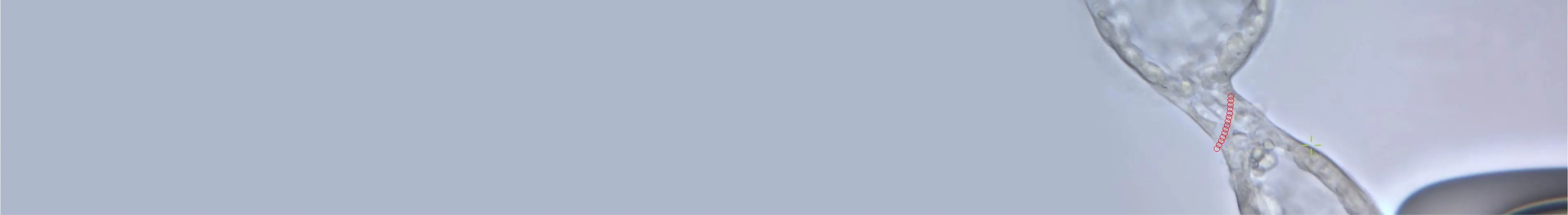 Hamilton Thorne LYKOS with DTS Clinical Laser